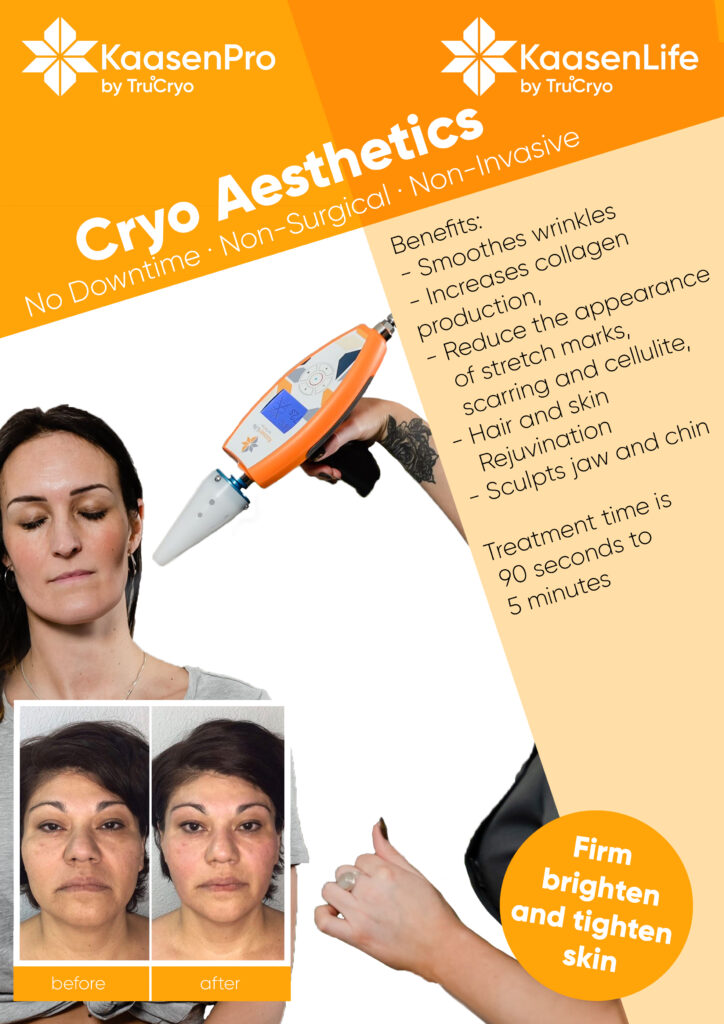 Cryo Sculpting in Costa Mesa Newport Beach Orange County
